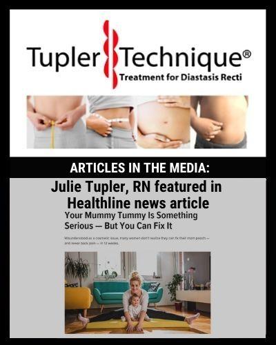 Revolutionizing Postpartum Recovery: Julie Tupler's Technique for Dias ...